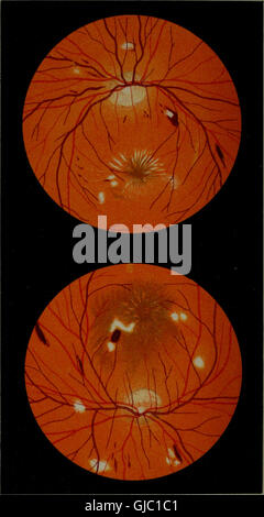 The 1910 Atlas and Epitome of Ophthalmoscopy provides detailed ...