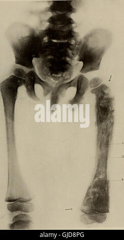 'Living Anatomy and Pathology' (1910) explores human anatomy and the ...