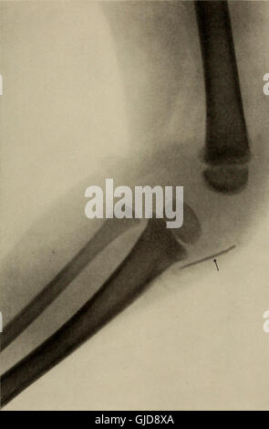 'Living Anatomy and Pathology' (1910) is a medical work focusing on ...