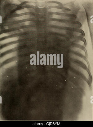 'Living Anatomy and Pathology' (1910) covers the study of human anatomy ...