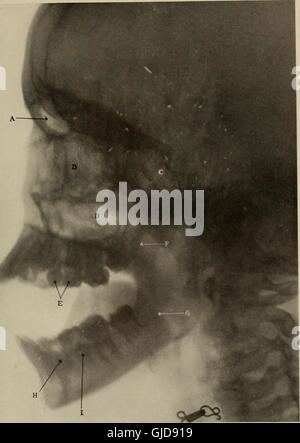 An image from 'Living Anatomy and Pathology' (1910), depicting medical ...