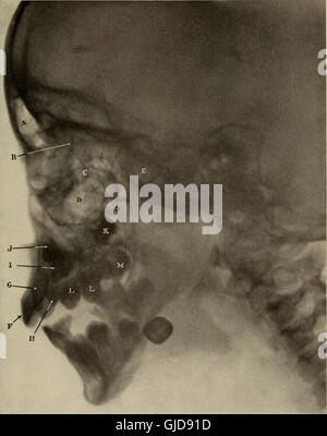 'Living Anatomy and Pathology' (1910) focuses on the anatomy of the ...