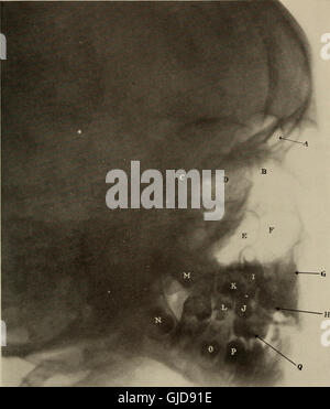 'Living Anatomy and Pathology' (1910) explores the anatomical structure ...