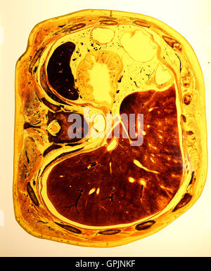 Human digestive system cross section Stock Photo: 34178593 - Alamy