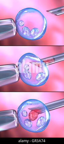3D illustration of artificial insemination process showings sperms ...