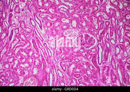 Human Kidney, Cortical Zone Under Microscope Stock Photo - Alamy