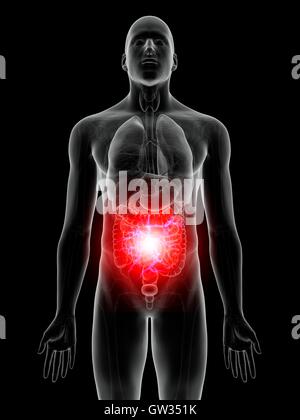 Human stomach pain, illustration Stock Photo - Alamy