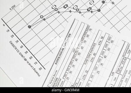 A hearing test graph with the evaluation form Stock Photo - Alamy