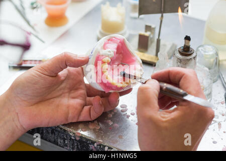 Fabrication of complete dentures Stock Photo - Alamy