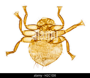 Bee louse fly, Braula coeca, photomicrograph Stock Photo - Alamy
