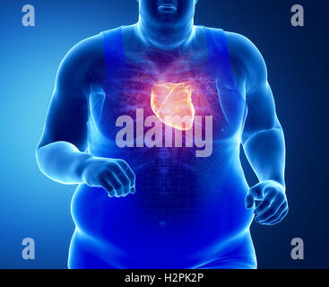 Fat obese man running with heart attack concept Stock Photo - Alamy
