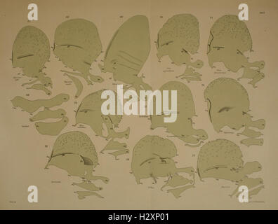 This plate focuses on the ear cartilage and outer ear structures of ...