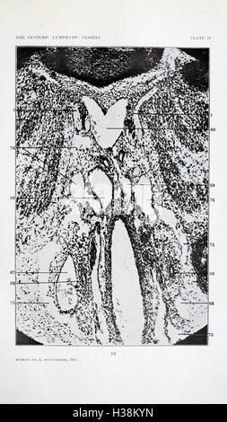 This work explores the anatomy and development of the lymphatic system ...