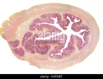 Fallopian tube. Light micrograph (LM) of a section through a fallopian ...