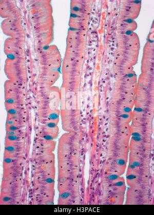 A light micrograph of a cross section of the jejunum clearly showing a ...