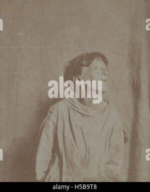 This portrait features a patient from the Surrey County Asylum, likely ...