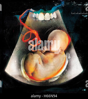 Human Fetus Illustration Stock Photo - Alamy