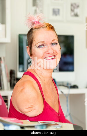 Artist Alison Lapper at home in Shoreham-by-Sea Stock Photo - Alamy