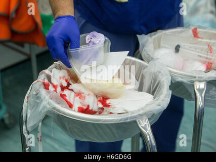 Used swabs in a dish in an operating theatre during an operation at an ...