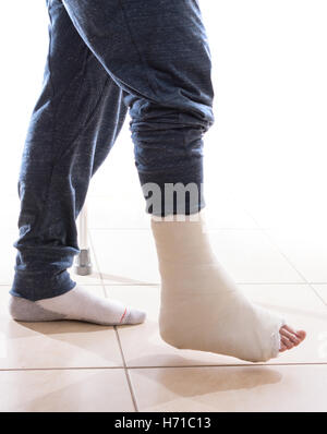 Ankle fracture cast Stock Photo - Alamy