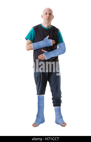 Young man with two broken ankles and dual blue casts on his legs ...