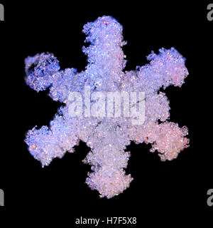 urine crystals at microscope Stock Photo - Alamy
