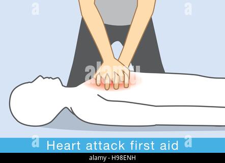 Emergency first aid CPR step by step procedure Stock Vector Image & Art ...