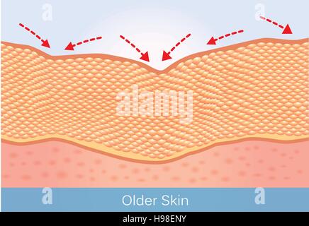 Illustration of young skin layers and components Stock Vector Image ...