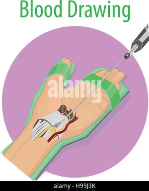 Anatomy of the elbow muscles medical vector illustration Stock Vector ...