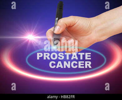 Word writing text Prostate Cancer. Business photo showcasing ...