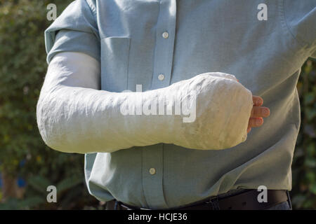 A green long arm plaster / fiberglass cast covering the wrist, arm, and ...