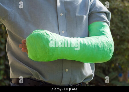 A green long arm plaster / fiberglass cast covering the wrist, arm, and ...