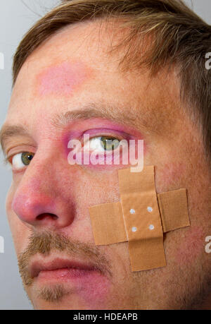 a medical self adhesive bandage band aid Stock Photo - Alamy