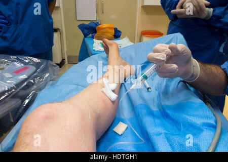 Foam sclerotherapy procedure involving ultrasound & injection ...