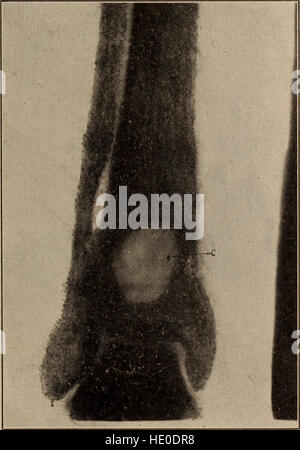 The Buffalo Medical Journal (1913) covers medical advancements ...