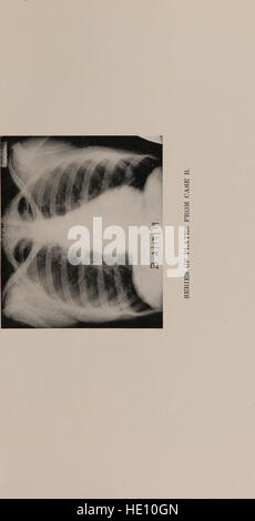 This 1919 medical study examines the correlation between X-ray findings ...