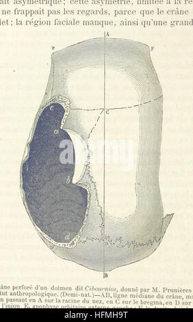 A study on trepanation and cranial amulets from the Neolithic era ...