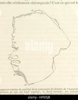 Study of cranial trepanation and the use of cranial amulets during the ...