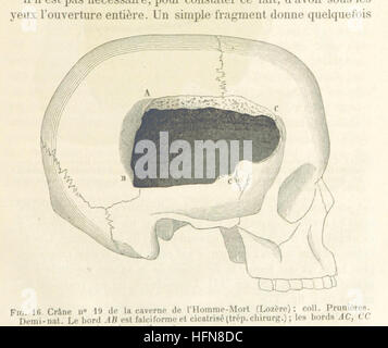A study on cranial trepanation and the use of cranial amulets during ...