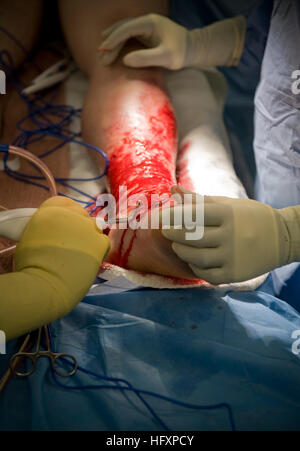 boiler explosion, burn victim, Center for the Intrepid, Emory S. Land ...