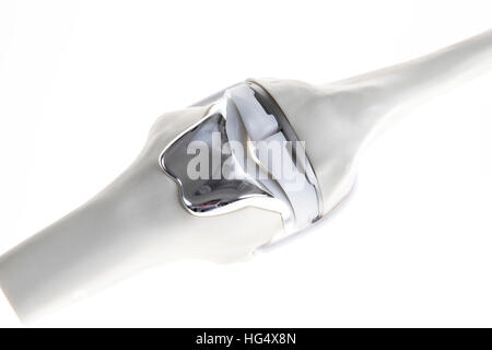 Knee prosthesis, knee endoprosthesis or knee joint prosthesis, on a ...