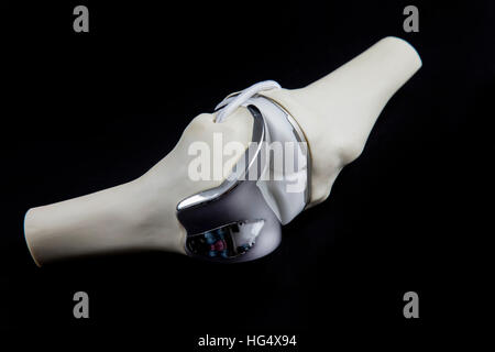 Knee prosthesis, knee endoprosthesis or knee joint prosthesis, on a ...