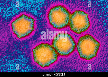 An electron micrograph of the Hepatitis A virus (HAV), an RNA virus ...