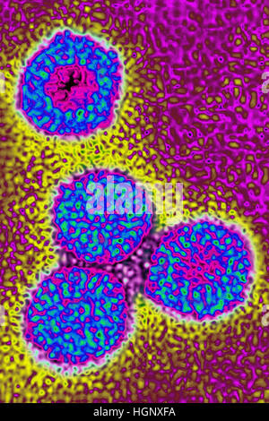 Transmission electron micrograph of rotavirus Stock Photo - Alamy