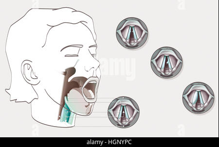 Human vocal cords and larynx, illustration Stock Photo - Alamy