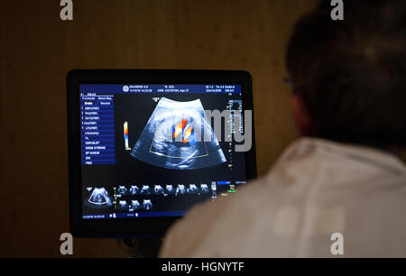 Doppler ultrasound blood flow test. Doctor using a Doppler ultrasound ...