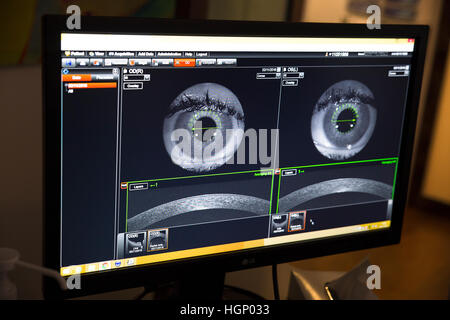 Optical coherence tomography eye exam using a Topcon OCT-1000 medical ...