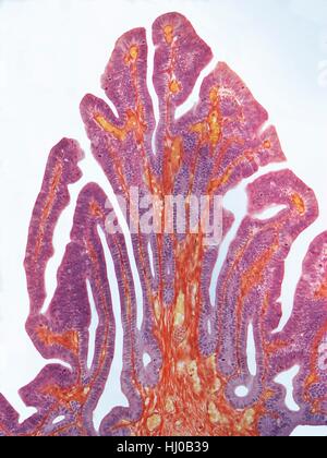 Fallopian tube. Light micrograph (LM) of a section through a fallopian ...
