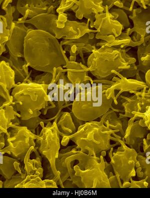 Activated platelets channels of open canalicular system (OCS),coloured ...