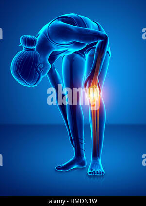3d Illustration of Women Knee pain Stock Photo - Alamy
